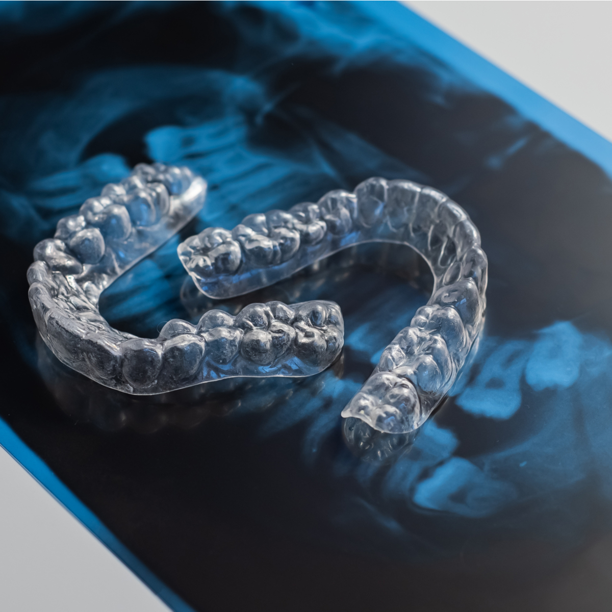 ClearCorrect Aligners Roswell Alpharetta GA Dentists