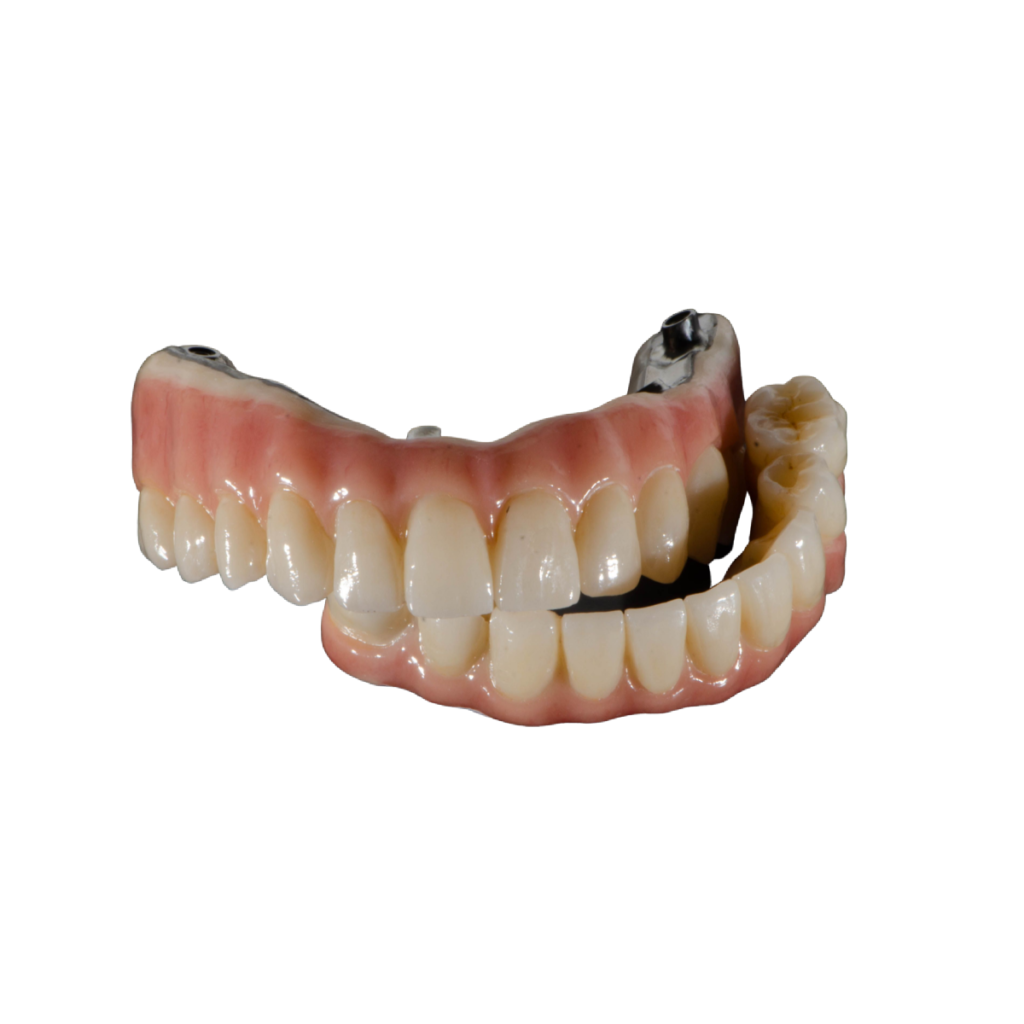 Implant-Supported Dentures | Alpharetta and Roswell, GA Dentists