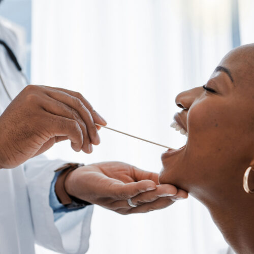 Oral Cancer Screenings | Alpharetta & Roswell, GA Dentists